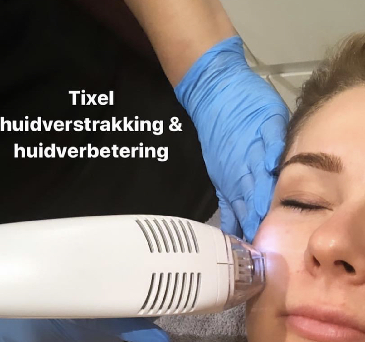 Nieuw; Tixel voor huidverstrakken en huidverbetering. | Be You skincare